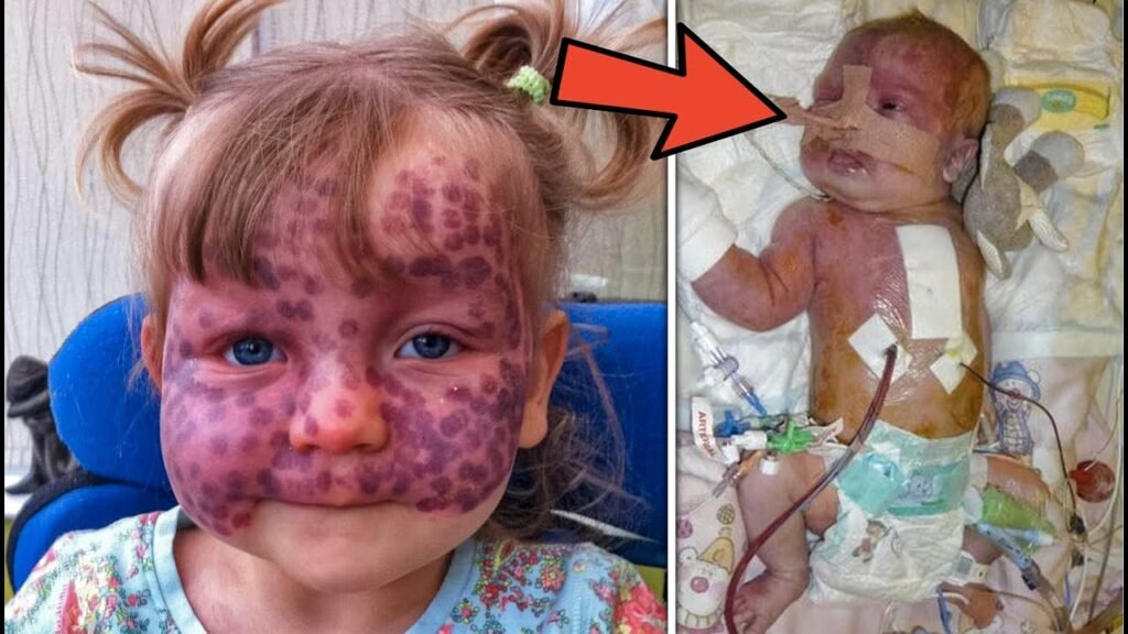 15 Real Life Human Giants That Really Exist